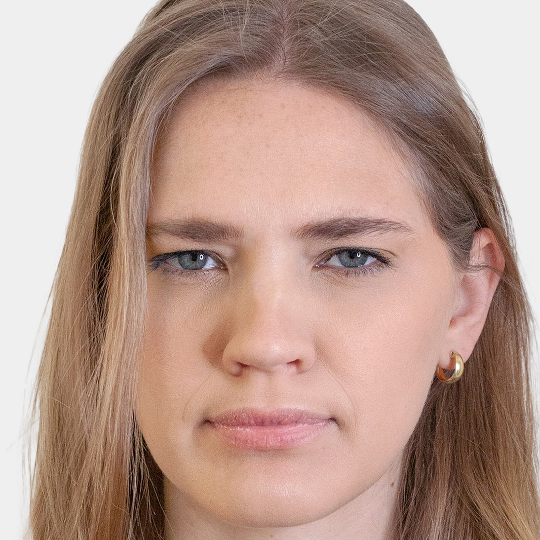 FDA Approved Botox: Preventative Wrinkle Care | Peachy